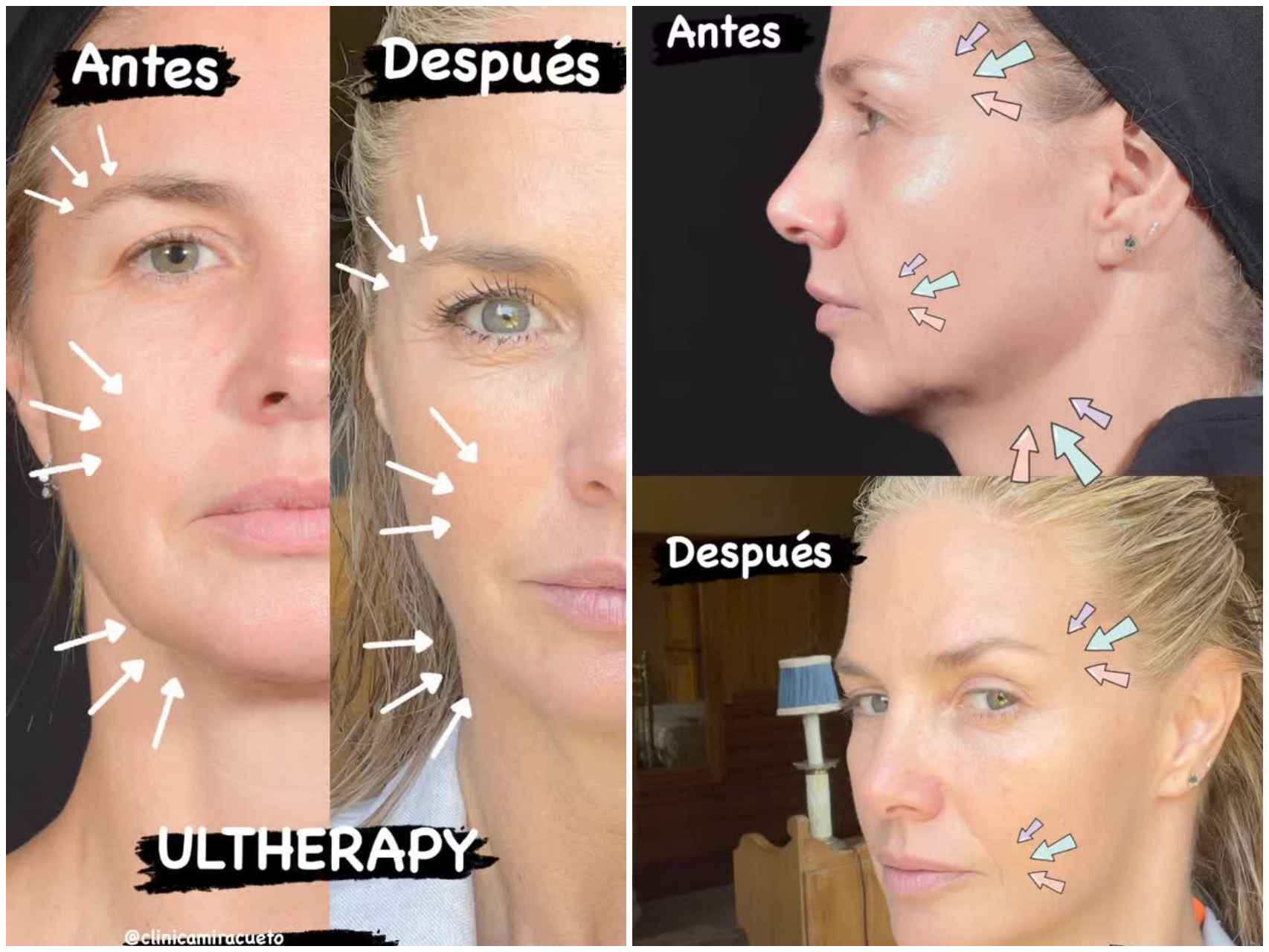 Transformación facial: resultados impresionantes antes y después